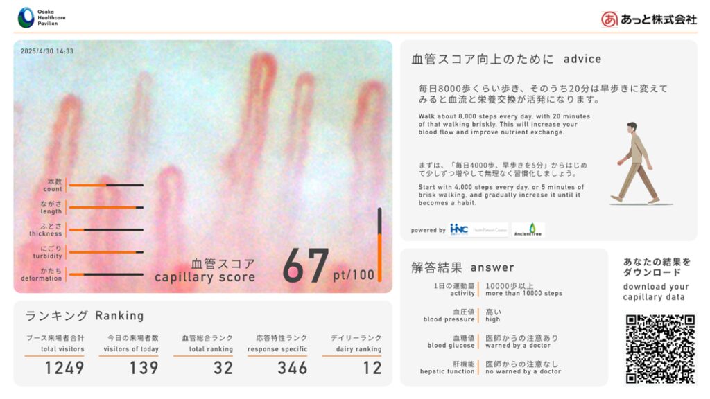 自分の毛細血管を“見る”時代へ、採血不要のスコープ『血管美人』 - Bplatz | 大阪産業創造館 中小企業情報サイト「ビープラッツ」